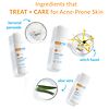 AcneFree 3 Step 24 Hour Acne Treatment Kit with Benzoyl Peroxide ...
