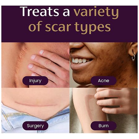 Mederma scar cream store