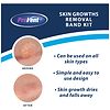 ProVent Skin Tag Removal Band Kit | Walgreens