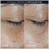 RoC Multi Correxion Revive + Glow Eye Balm with Vitamin C Fragrance ...